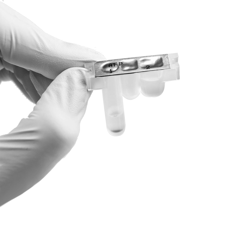 LUMIPULSE® G1200 - a robust, mid-sized, fully automated immunoassay ...